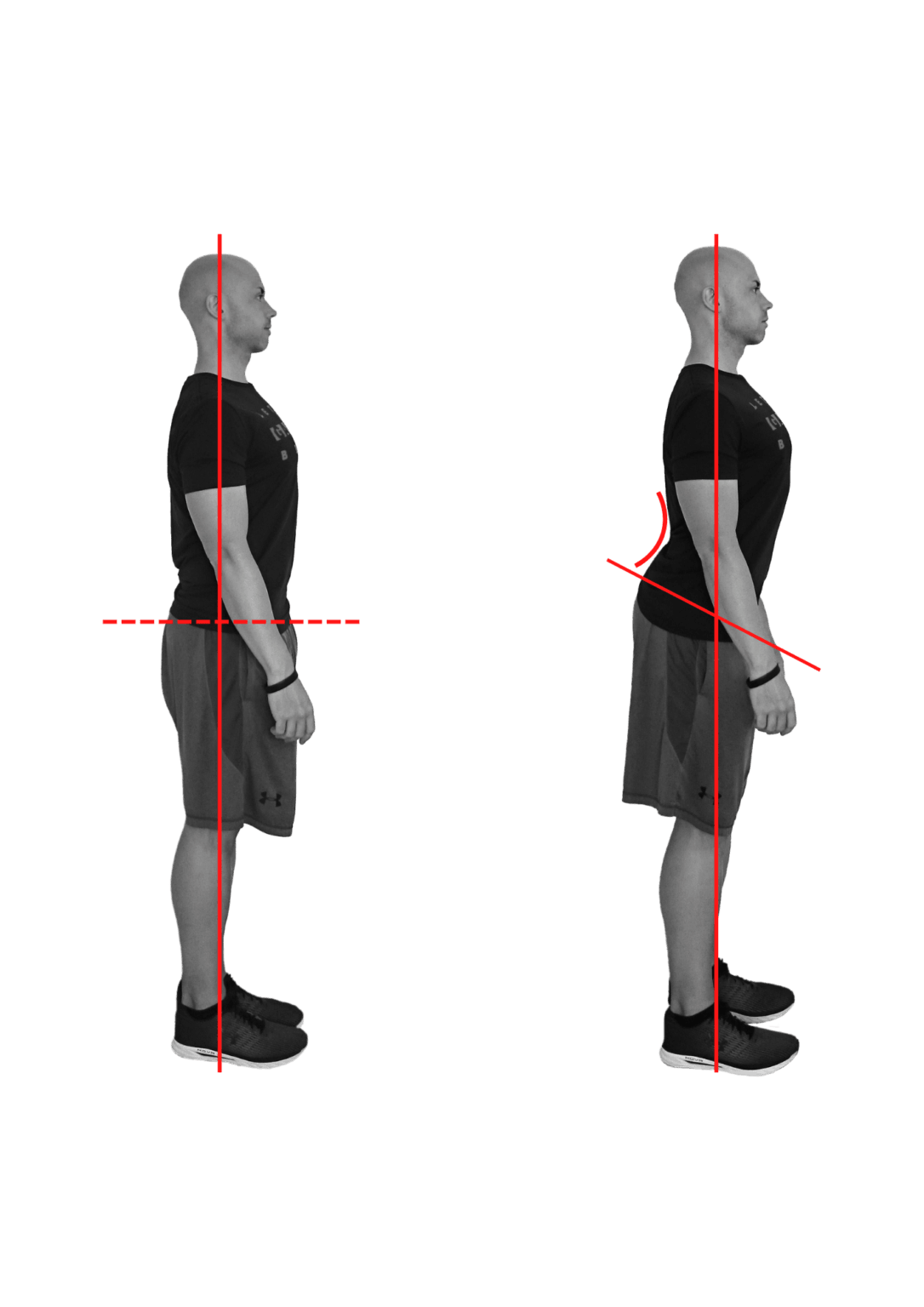Hyperlordose LWS – Was ist ein Hohlkreuz? | Fitness Einfach Erklärt