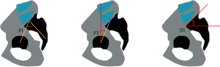 Hyperlordose LWS – Was ist ein Hohlkreuz? | Fitness Einfach Erklärt
